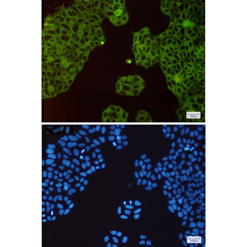 Rabbit Monoclonal Antibody to c-Met-远泰生物