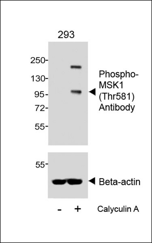 Rabbit Polyclonal Antibody to Phospho-MSK1 (Thr581)_Phospho-MSK1 (Thr581)-远泰生物抗体定制