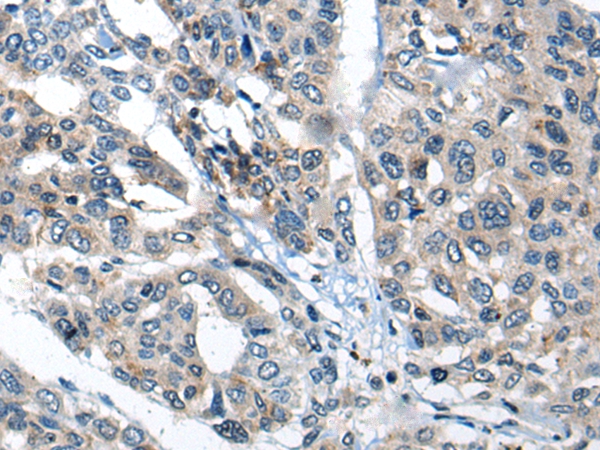 Rabbit Polyclonal Antibody to THRA/THRB-远泰生物