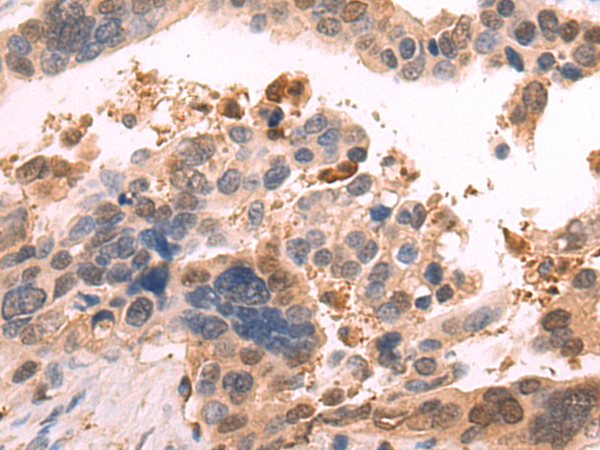 Rabbit Polyclonal Antibody to AKR1B1_AKR1B1-远泰生物