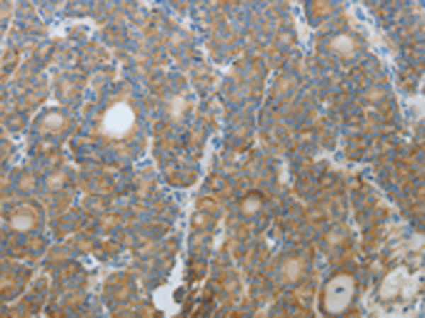 Rabbit Polyclonal Antibody to CXCR3_CXCR3-远泰生物抗体定制