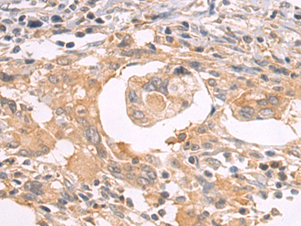 Rabbit Polyclonal Antibody to GPC6-远泰生物