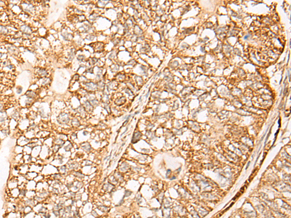Rabbit Polyclonal Antibody to NR0B2_NR0B2-远泰生物抗体定制