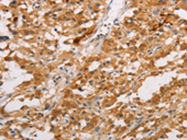 Rabbit Polyclonal Antibody to ARMCX3-远泰生物