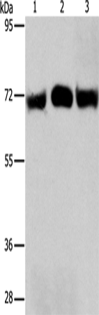 Rabbit Polyclonal Antibody to RPN1_RPN1-远泰生物抗体定制