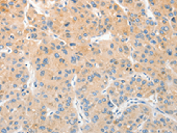 Rabbit Polyclonal Antibody to RPN1_RPN1-远泰生物抗体定制