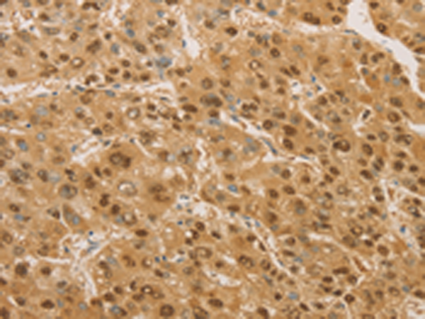 The image is immunohistochemistry of paraffin-embedded Human liver ...