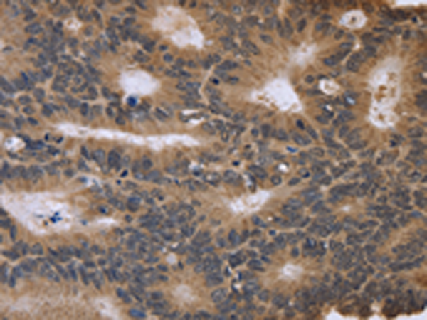 Rabbit Polyclonal Antibody to FGFR1OP2-远泰生物