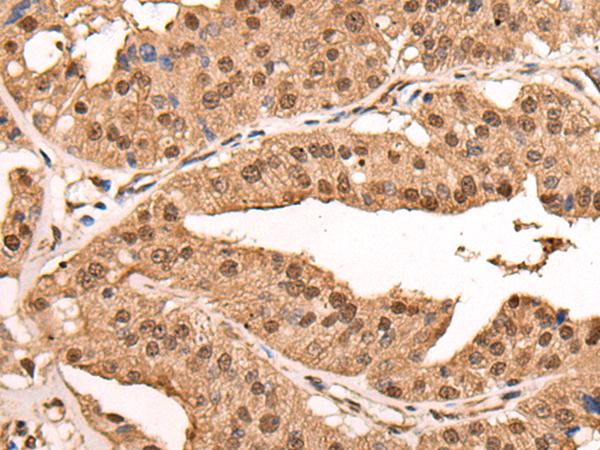 Rabbit Polyclonal Antibody to ATRIP_ATRIP-远泰生物抗体定制