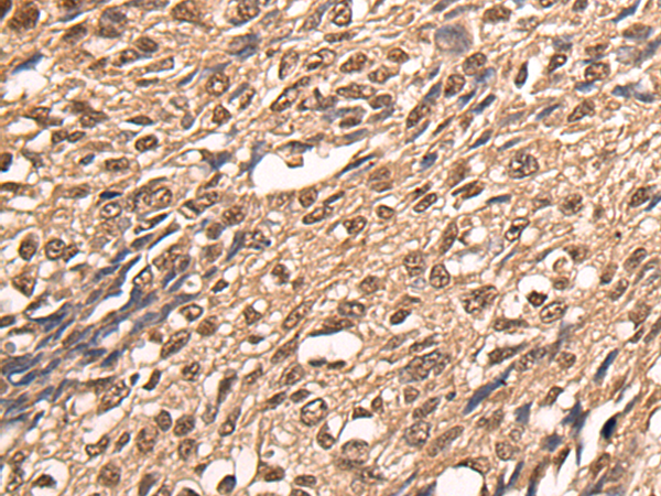 Rabbit Polyclonal Antibody to ATRIP_ATRIP-远泰生物抗体定制