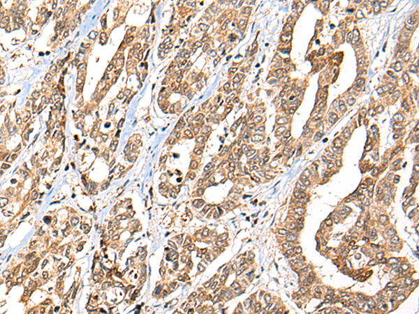 Rabbit Polyclonal Antibody to UTP4_UTP4-远泰生物抗体定制