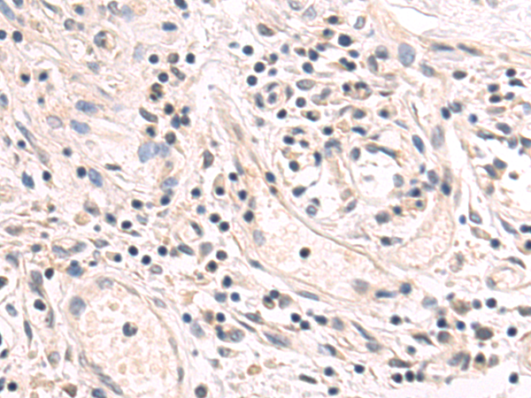 Rabbit Polyclonal Antibody to FOLR1_FOLR1-远泰生物抗体定制