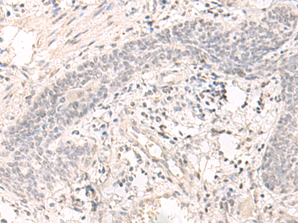 Rabbit Polyclonal Antibody to SAP130_SAP130-远泰生物抗体定制