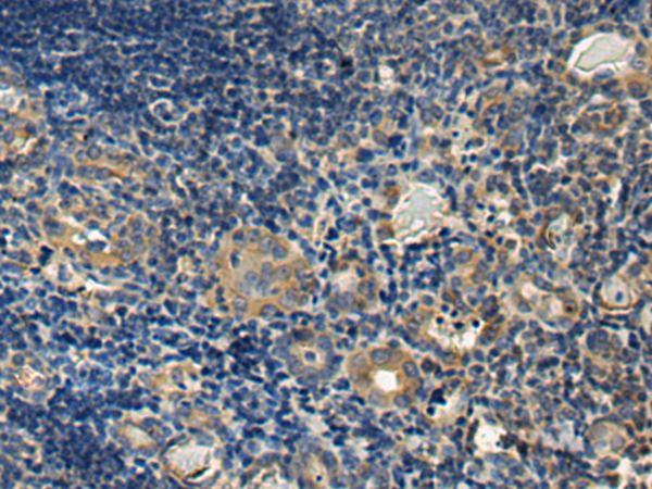 Rabbit Polyclonal Antibody to AP3B1-远泰生物