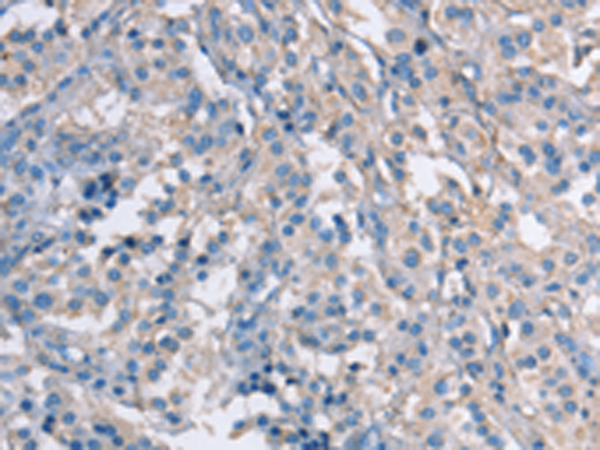Rabbit Polyclonal Antibody to ZAP70 _ZAP70 -远泰生物抗体定制