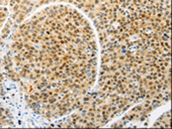 Rabbit Polyclonal Antibody to RAN-远泰生物