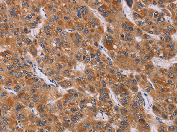 Rabbit Polyclonal Antibody to CALCA/CALCB_CALCA/CALCB-远泰生物抗体定制