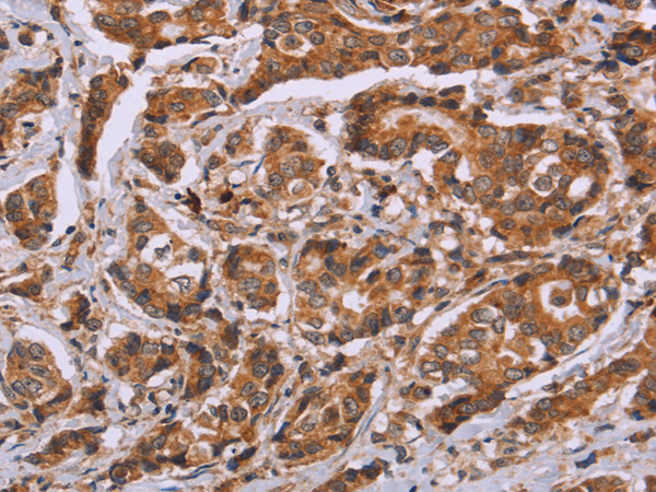 Rabbit Polyclonal Antibody to CALCA/CALCB_CALCA/CALCB-远泰生物抗体定制