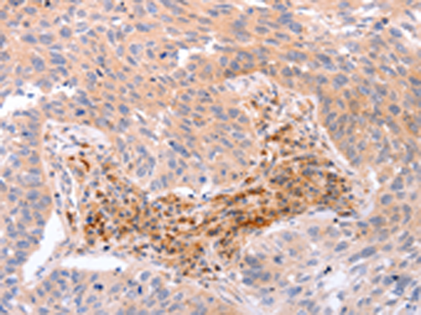 Rabbit Polyclonal Antibody to NR3C1_NR3C1-远泰生物抗体定制