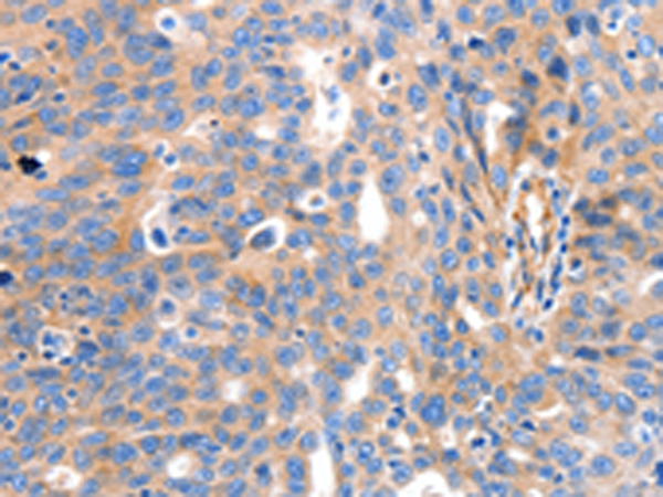 Rabbit Polyclonal Antibody to IGFBP7_IGFBP7-远泰生物抗体定制