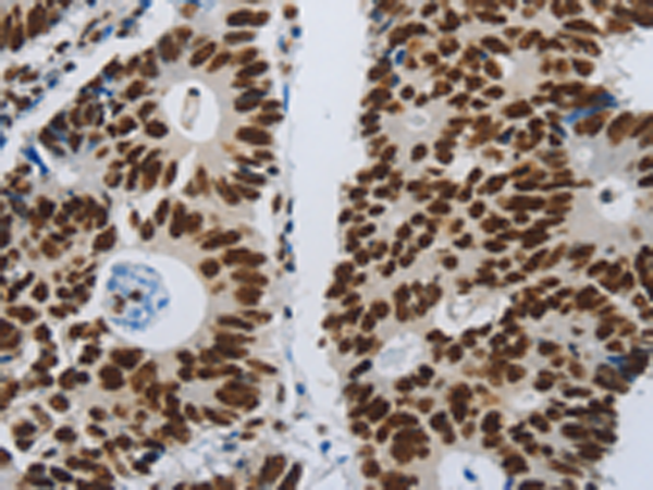 Rabbit Polyclonal Antibody to SLC16A14-远泰生物