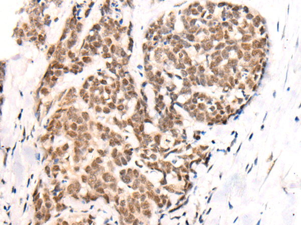 Rabbit Polyclonal Antibody to PIAS3_PIAS3-远泰生物抗体定制