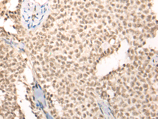 Rabbit Polyclonal Antibody to PIAS3_PIAS3-远泰生物抗体定制