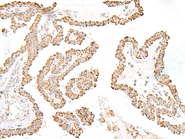 Rabbit Polyclonal Antibody to ITGB6_ITGB6-远泰生物抗体定制