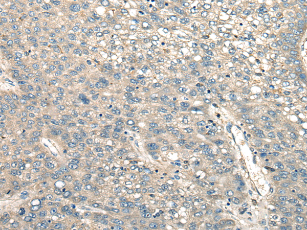 Rabbit Polyclonal Antibody to PIAS3-远泰生物