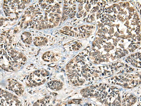 Rabbit Polyclonal Antibody to PIAS3-远泰生物