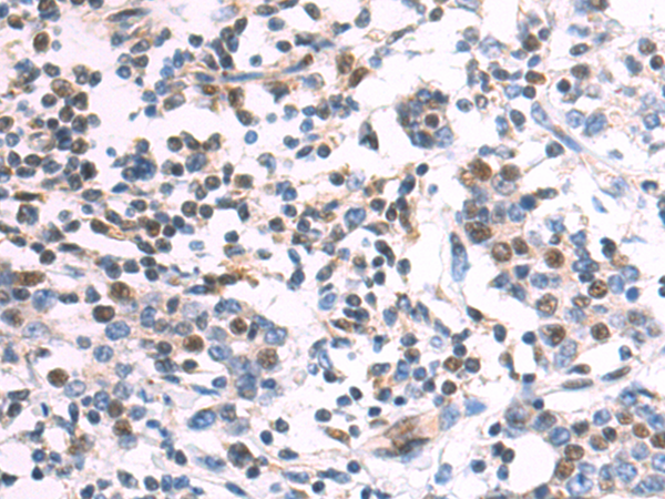 Rabbit Polyclonal Antibody to PIAS3_PIAS3-远泰生物抗体定制