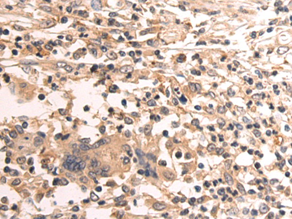 Rabbit Polyclonal Antibody to FOLR1_FOLR1-远泰生物抗体定制
