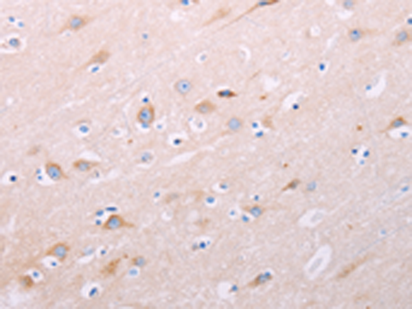 Rabbit Polyclonal Antibody to ADCY5_ADCY5-远泰生物抗体定制