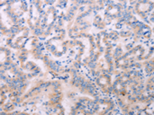 Rabbit Polyclonal Antibody to ADCY5_ADCY5-远泰生物抗体定制