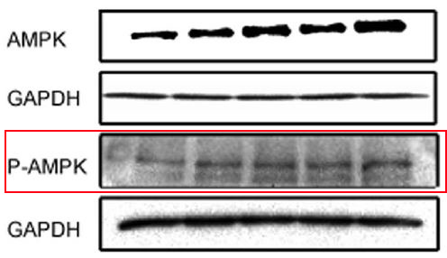 Rabbit Monoclonal to Phospho-AMPK alpha(Thr172)_Phospho-AMPK alpha ...