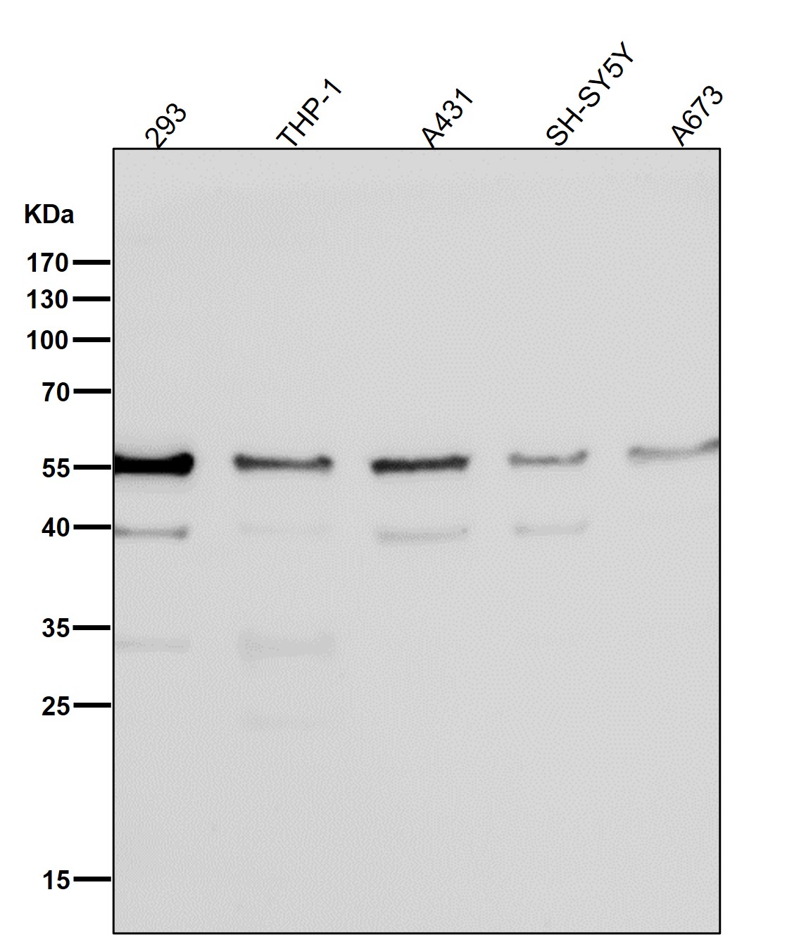 Rabbit Monoclonal to ATGL/PNPLA2-远泰生物