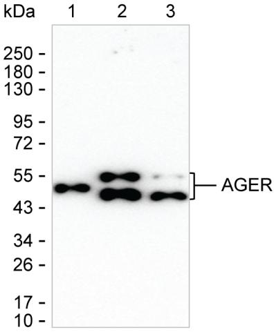 Mouse Monoclonal Antibody to AGER-远泰生物