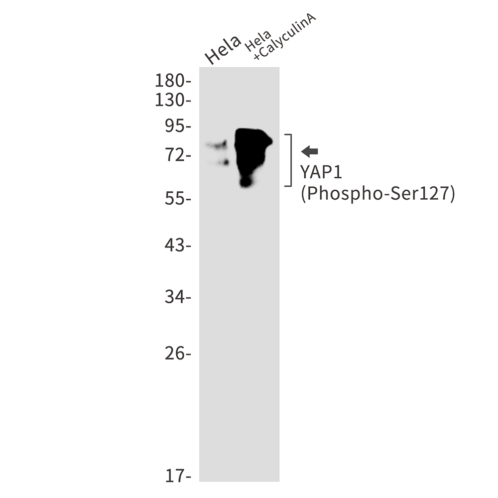 Western blot analysis of Phospho-YAP1 (Ser127) in Hela, Hela+CalyculinA ...
