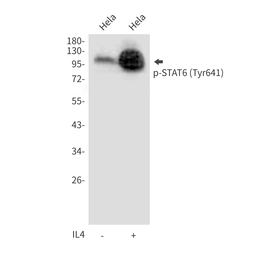 Rabbit Polyclonal Antibody to Phospho-STAT6 (Tyr641)-远泰生物