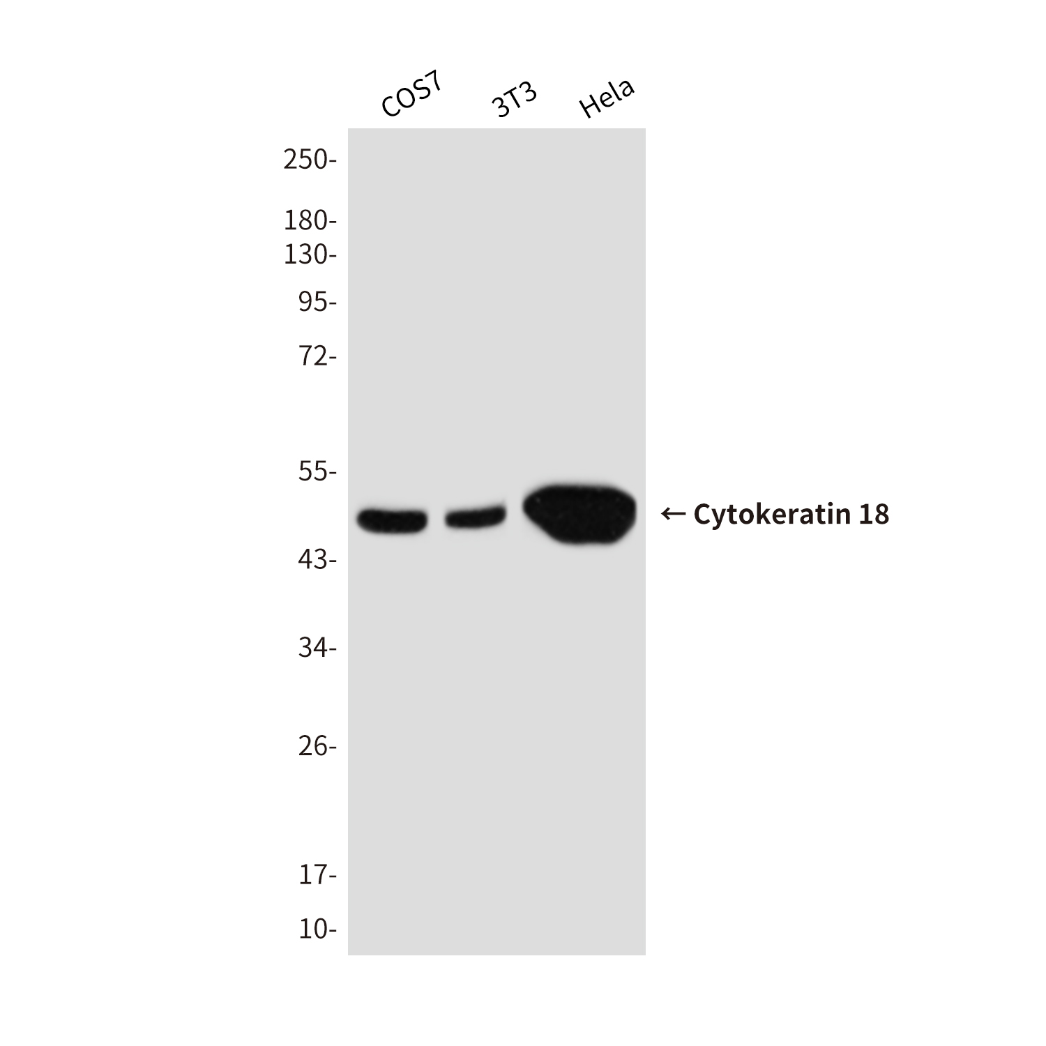 Mouse Monoclonal Antibody to Cytokeratin 18-远泰生物