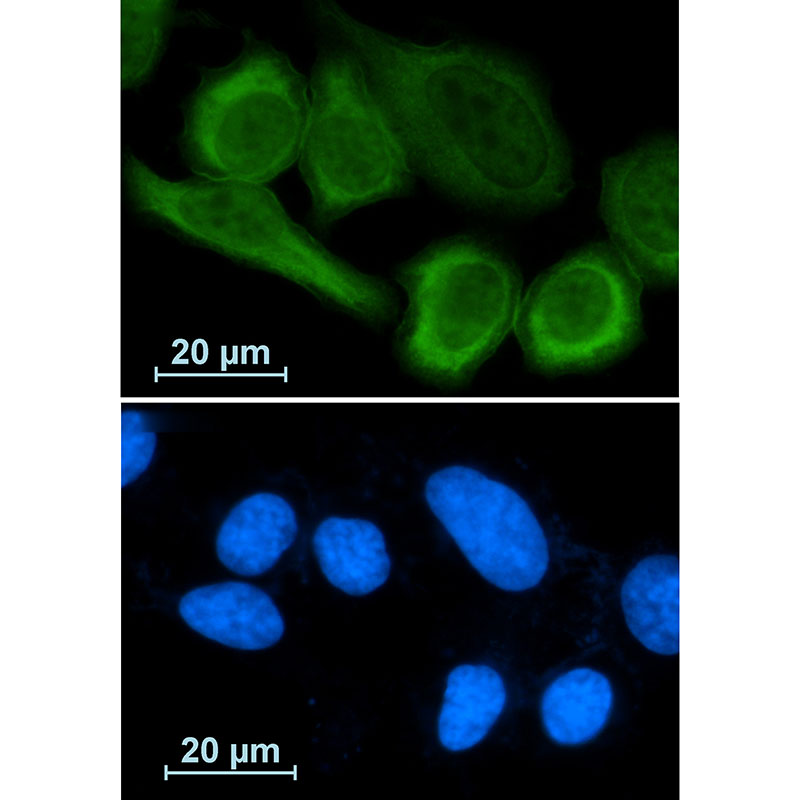 Rabbit Monoclonal Antibody to Annexin A1_Annexin A1-远泰生物抗体定制
