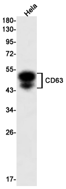 Rabbit Monoclonal Antibody to CD63_CD63-远泰生物