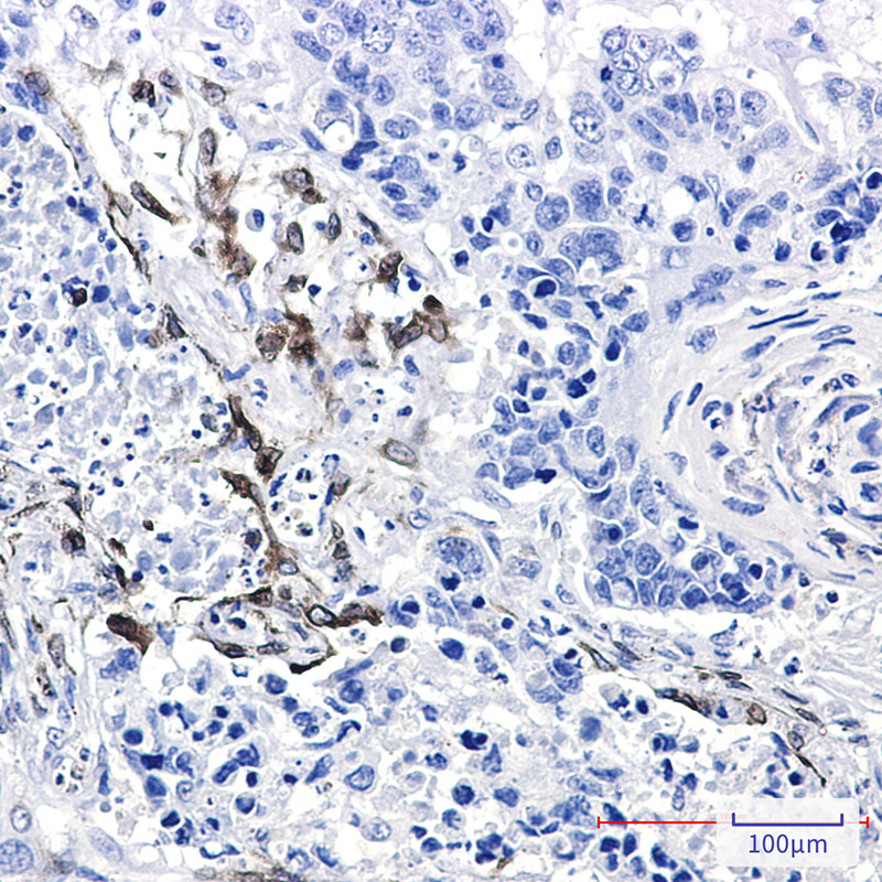 Rabbit Monoclonal Antibody to Cyclooxygenase 2-远泰生物