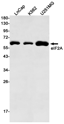 Rabbit Monoclonal Antibody to eIF2A_eIF2A-远泰生物抗体定制