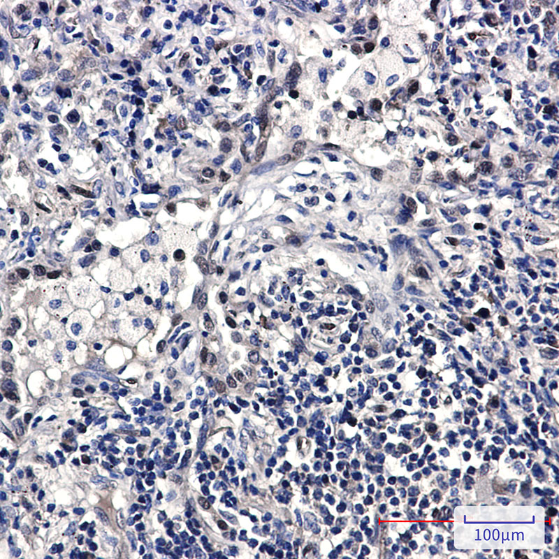 Rabbit Monoclonal Antibody to FDPS_FDPS-远泰生物抗体定制