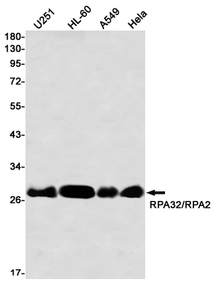 Rabbit Monoclonal Antibody to RPA32_RPA32-远泰生物抗体定制