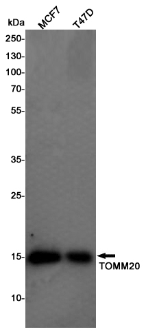 Rabbit Polyclonal Antibody to TOMM20-远泰生物